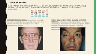 Todos los tipos de Facies y sus patologías | PPTX