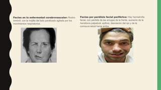 Todos los tipos de Facies y sus patologías | PPTX