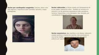 Todos los tipos de Facies y sus patologías | PPTX