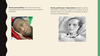 Todos los tipos de Facies y sus patologías | PPTX