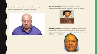 Todos los tipos de Facies y sus patologías | PPTX