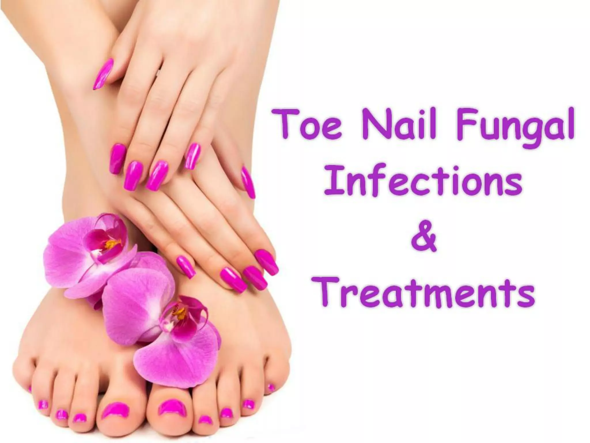 Toe Nail Fungal Infections & Treatments | PDF