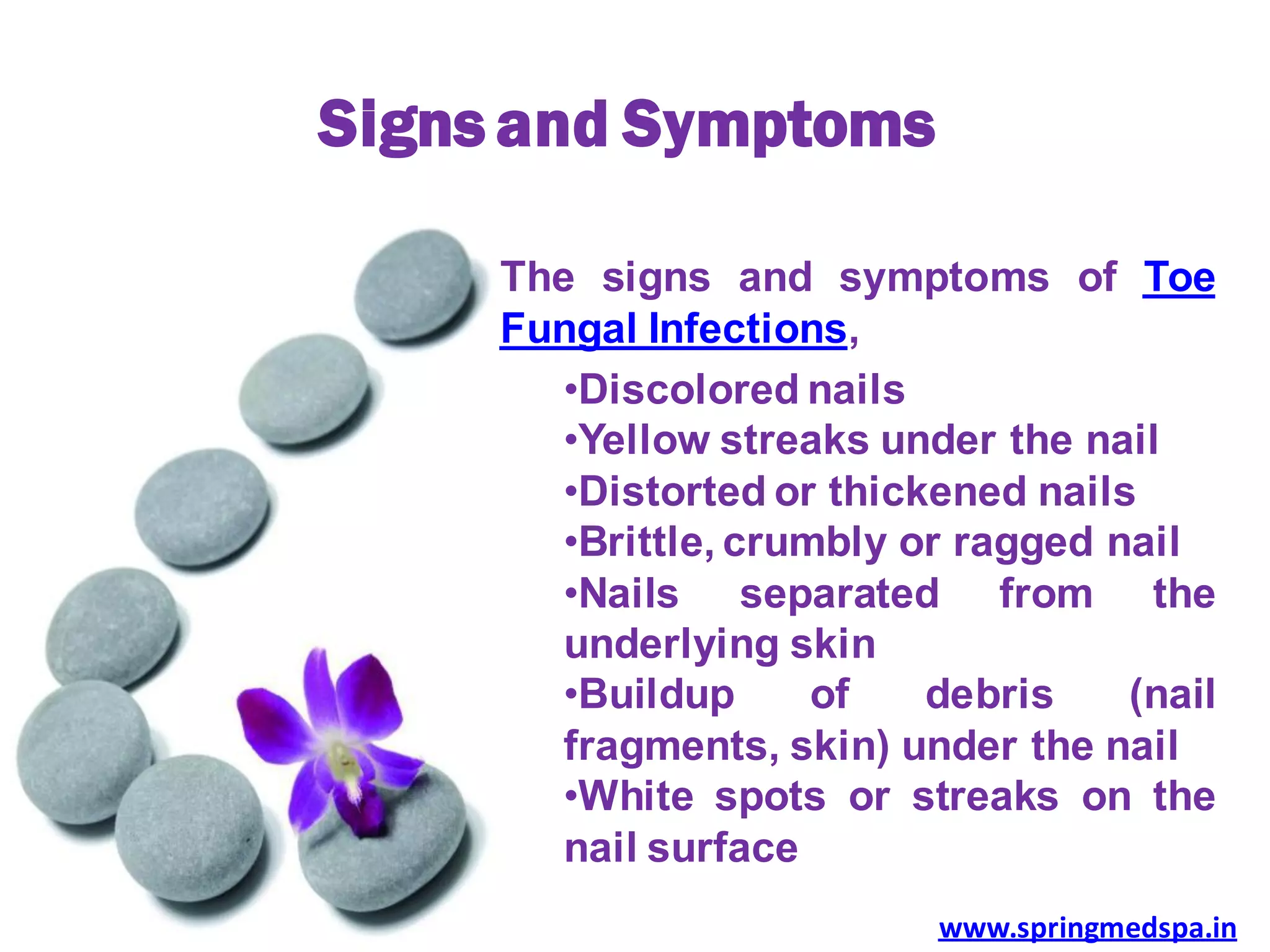 Toe Nail Fungal Infections & Treatments | PDF