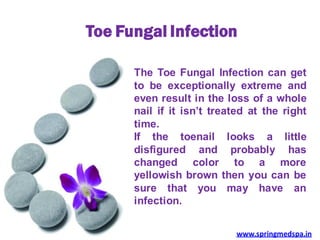 Toe Nail Fungal Infections & Treatments | PDF