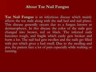 Toe nail fungus medicine:- An Effective Medicine for Toe Nails Fungus | PPT