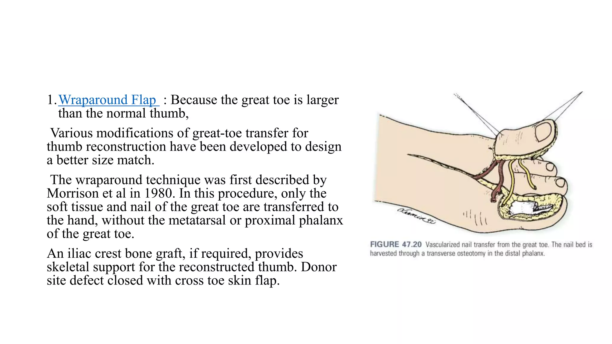 TOE to THUMB transfer ppt.pptx