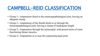 TOE to THUMB transfer ppt.pptx