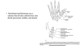TOE to THUMB transfer ppt.pptx