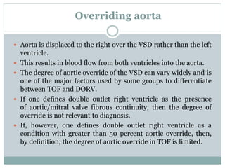 Tetrology of Fallot (TOF) - A Review | PPTX