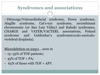 Tetrology of Fallot (TOF) - A Review | PPTX