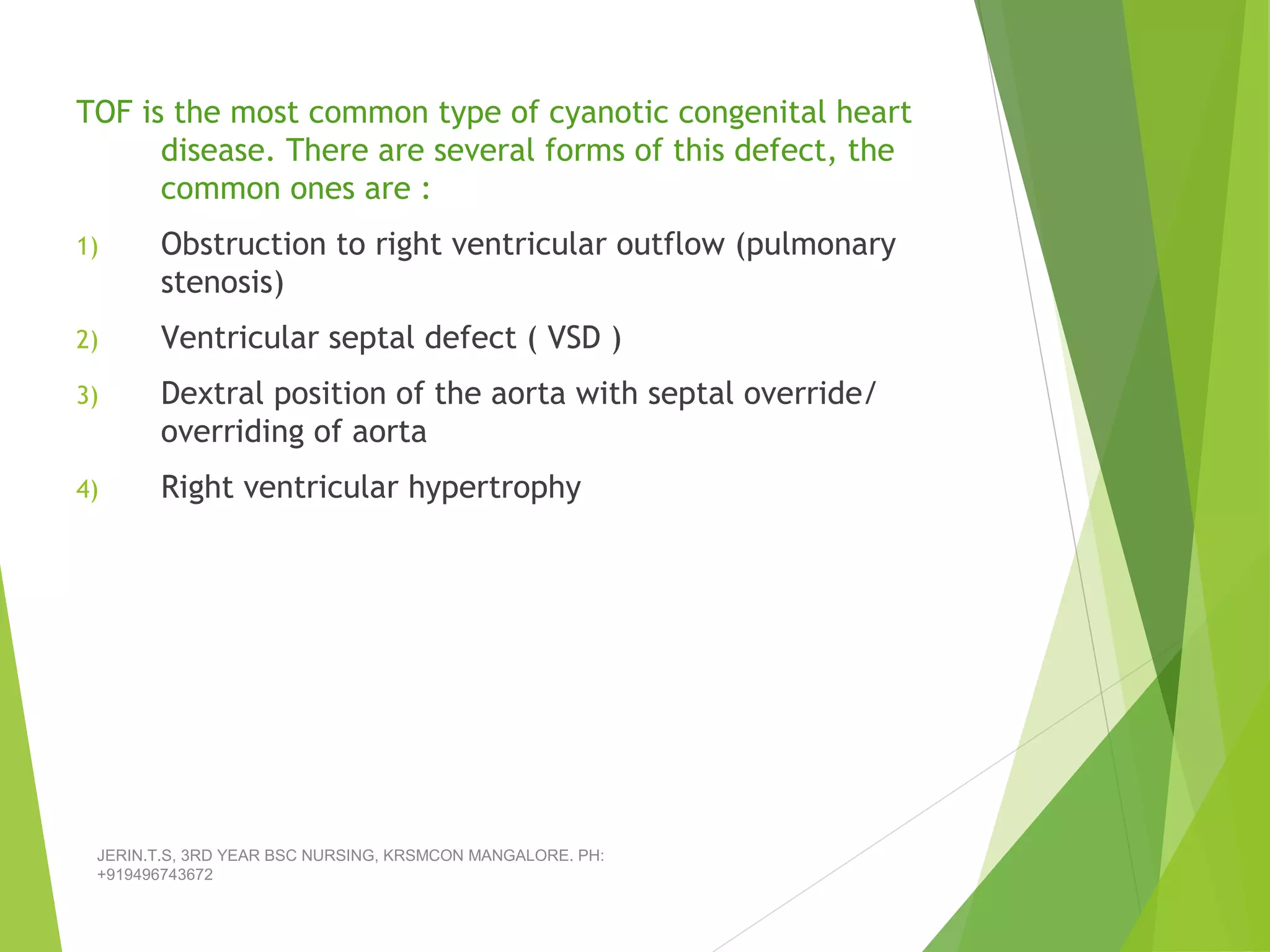 Tof | PPT