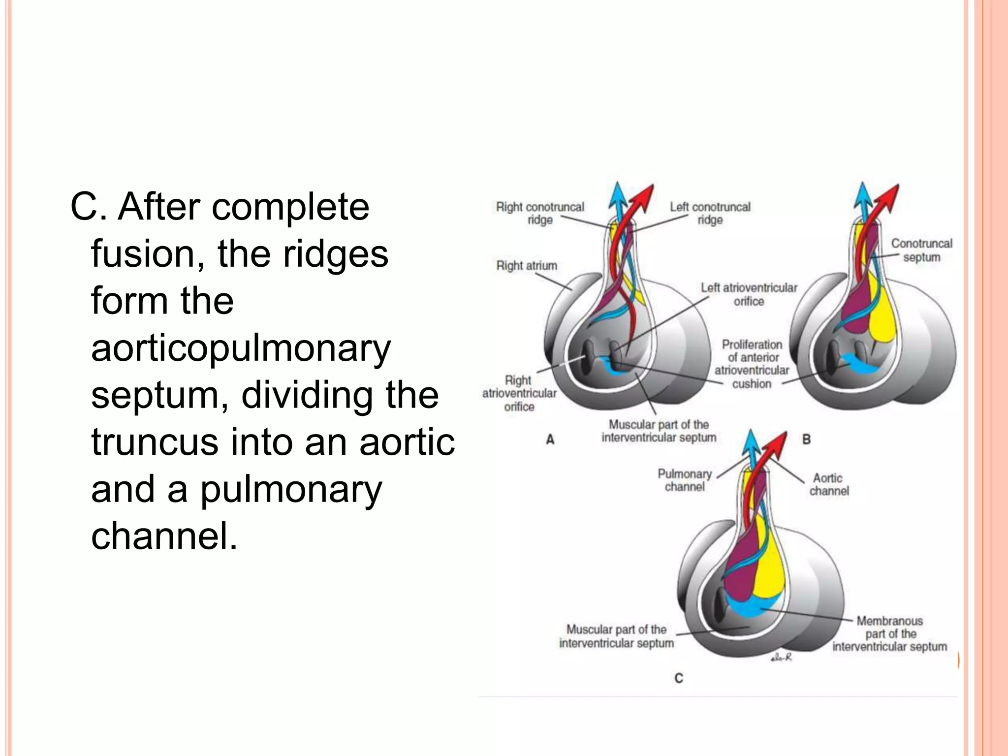 Tetralogy of Fallot (TOF) | PPTX