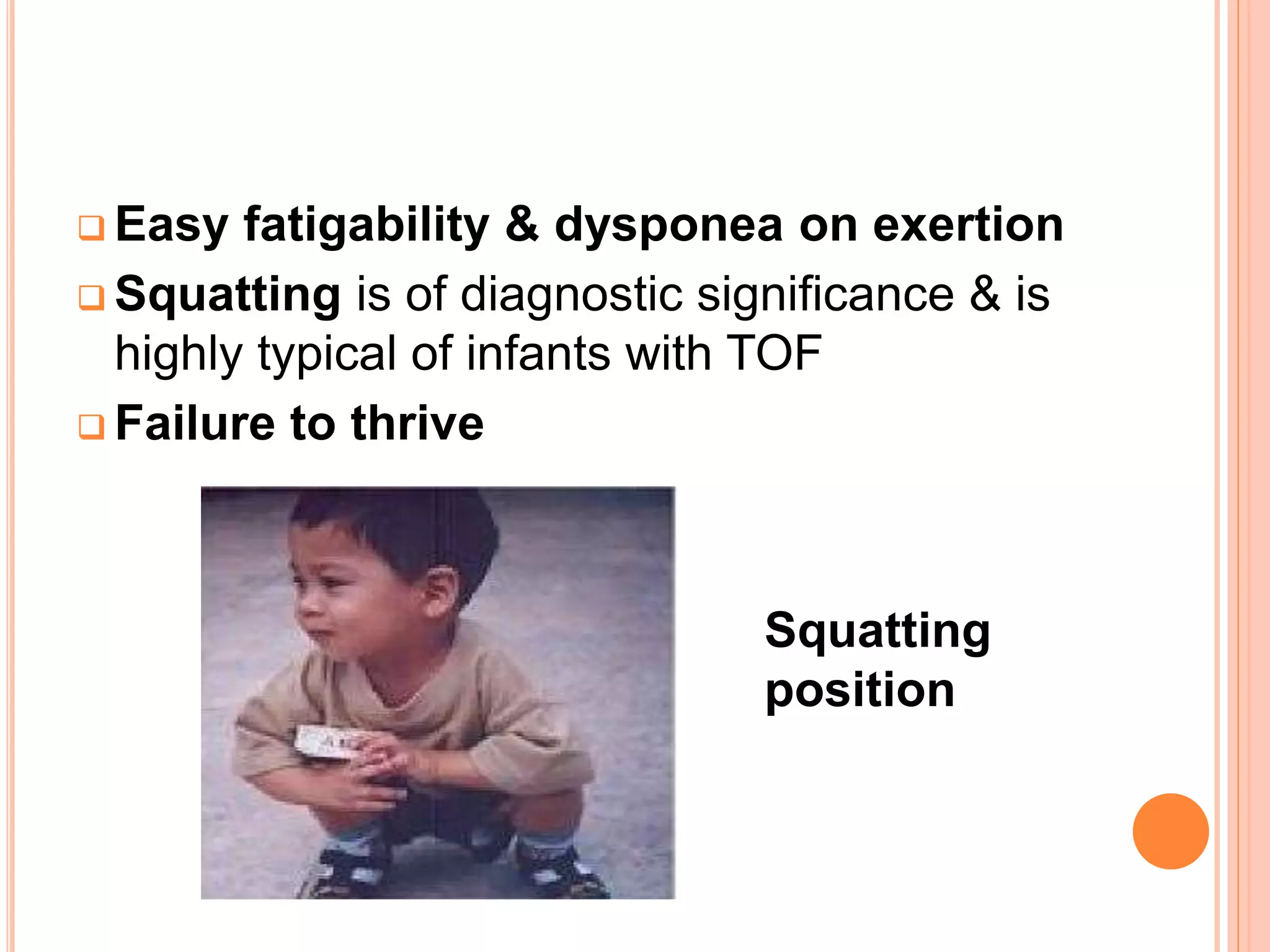 Tetralogy of Fallot (TOF) | PPTX