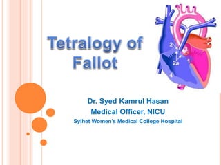 Tetralogy of Fallot (TOF) | PPTX