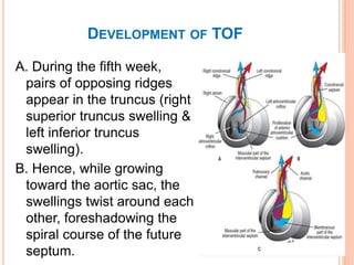Tetralogy of Fallot (TOF) | PPTX