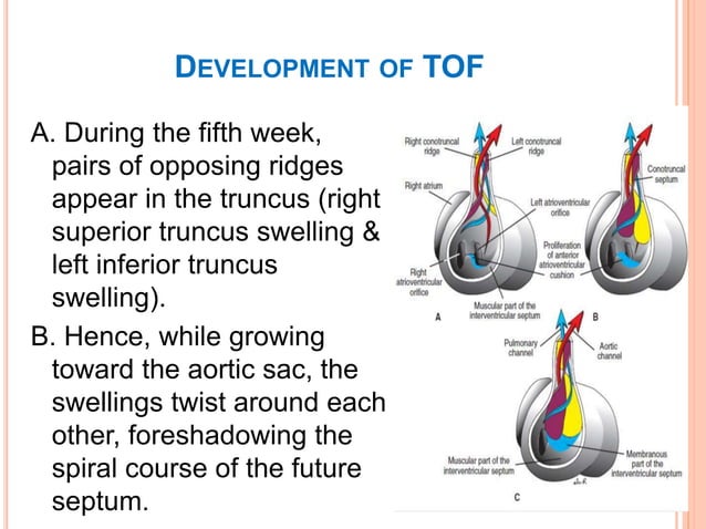 Tetralogy of Fallot (TOF) | PPTX