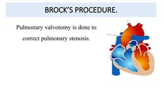 Tetralogy of Fallot from B.SC nursing 6th semester | PPTX
