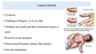 Tetralogy of Fallot from B.SC nursing 6th semester | PPTX