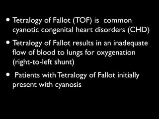 TOF, VSD in children | PPT