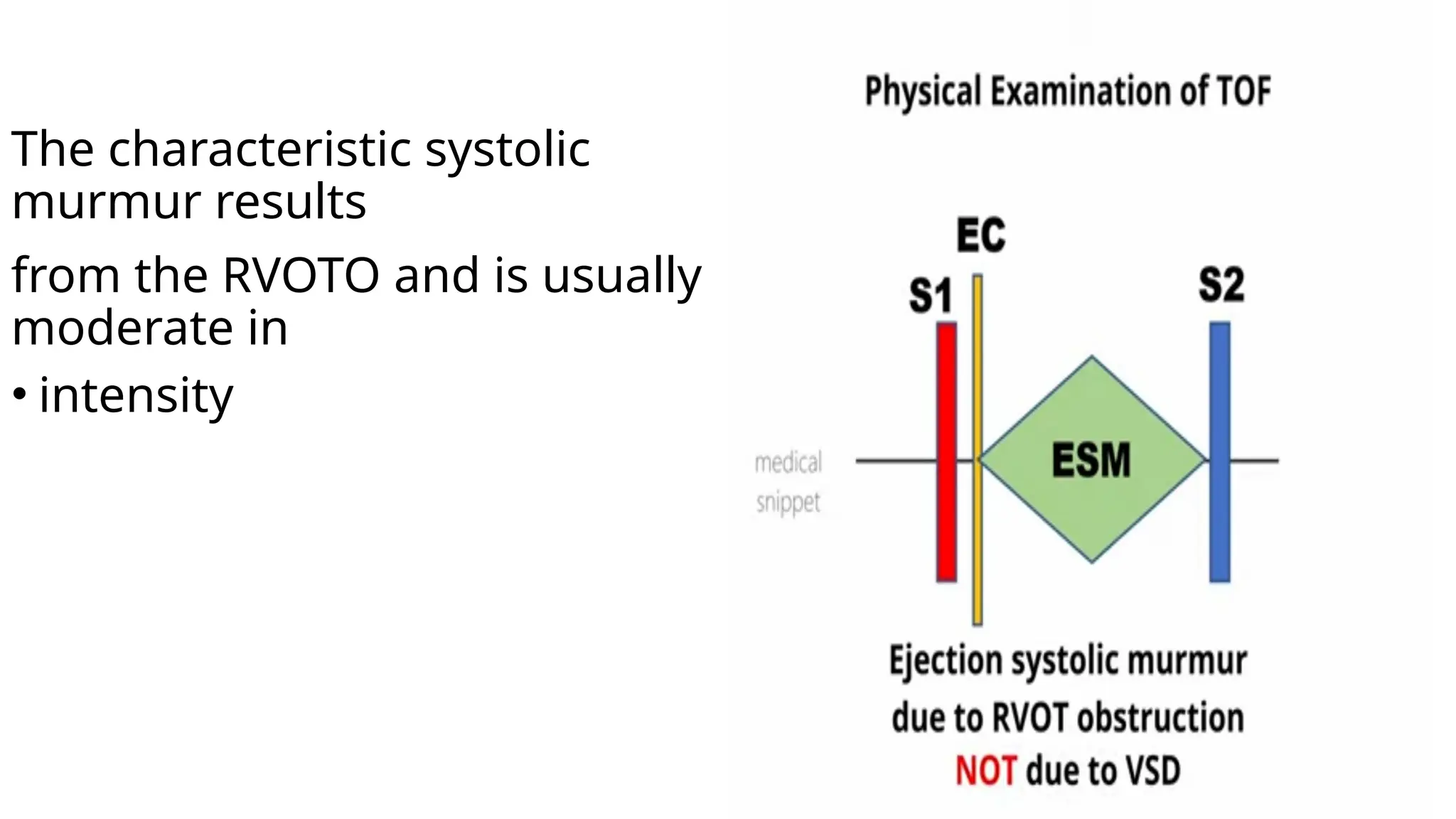 TOF BY DR POOJA anatomy tetralogy of fallot.pptx