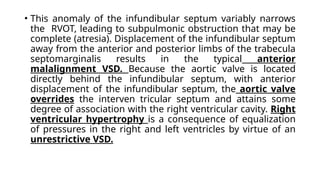 TOF BY DR POOJA anatomy tetralogy of fallot.pptx