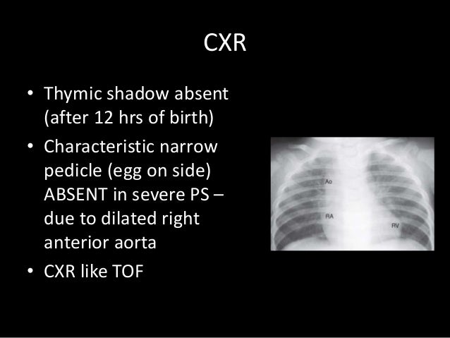 Approach to TOF physiology