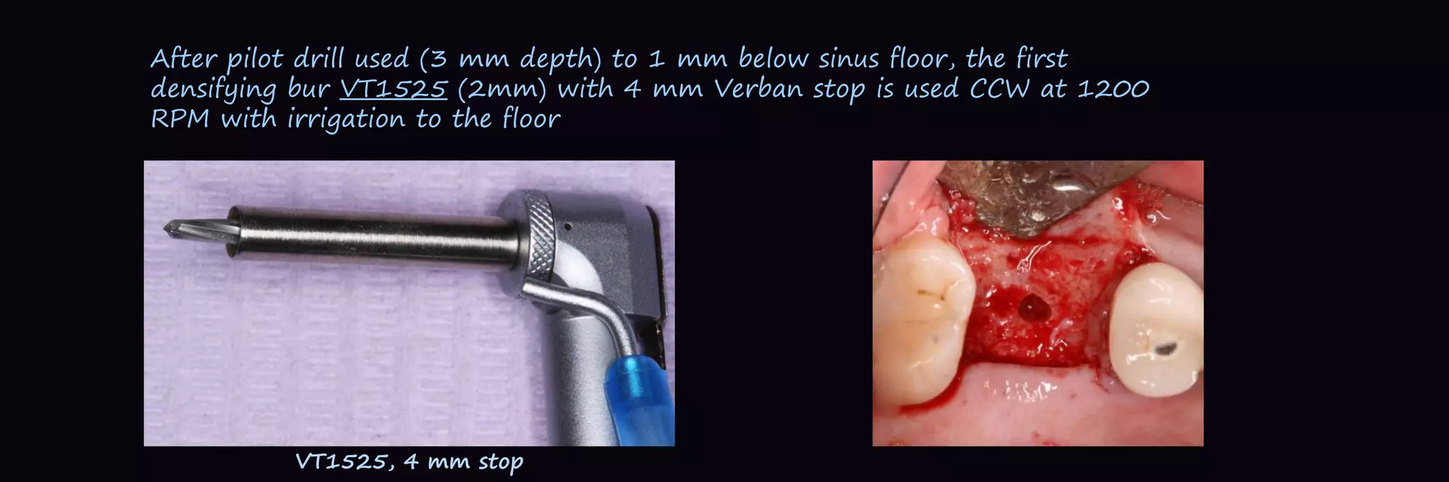 Toffler densah lift | PPT | Free Download