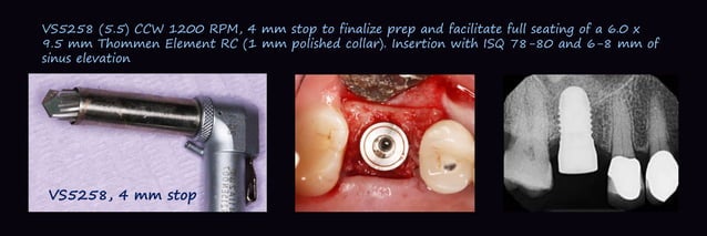 Toffler densah lift | PPTX