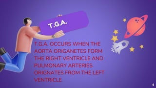 TOA (TRANSPOSION OF GREAT ARTERIES) | PPTX