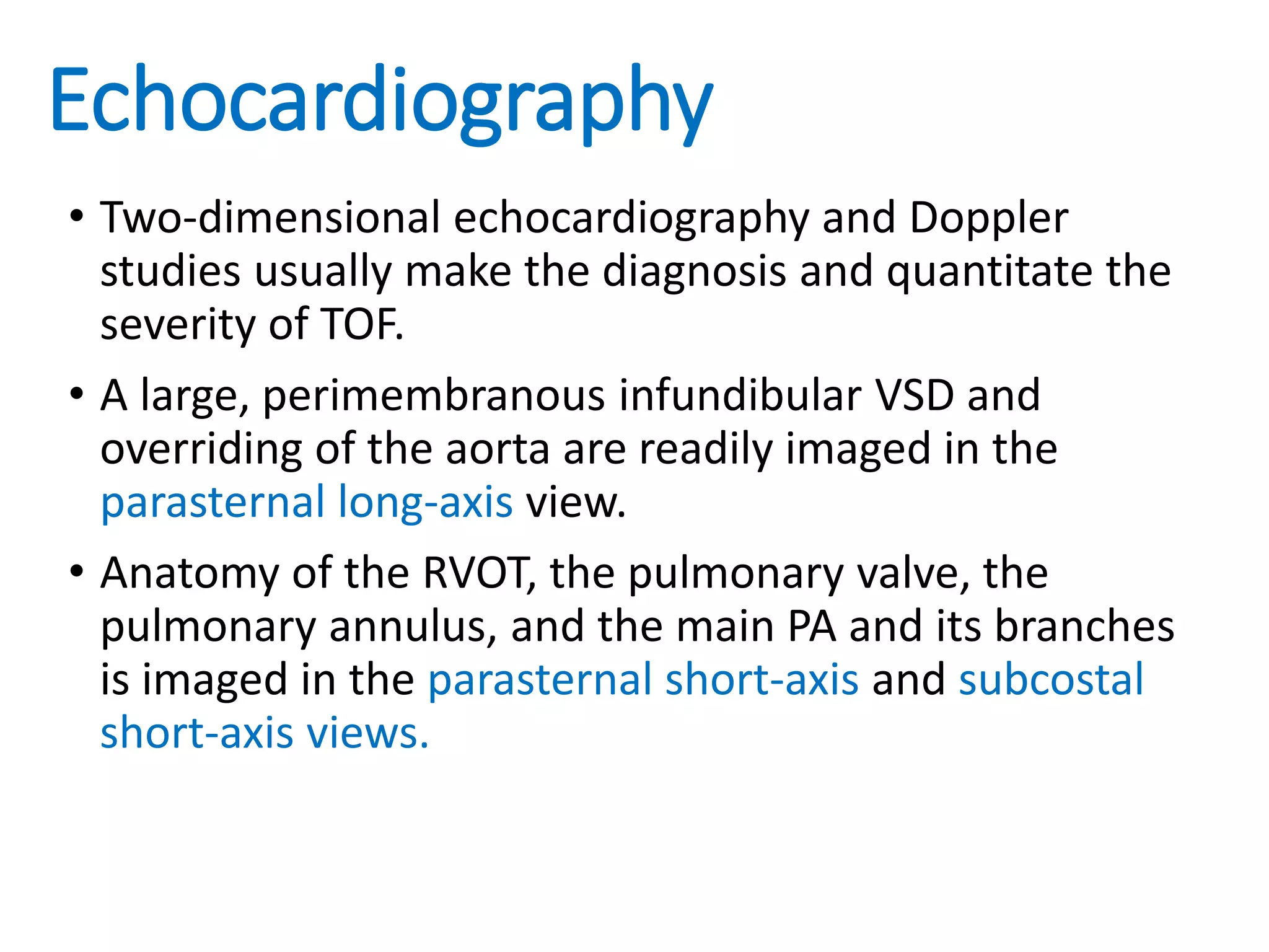 Tetralogy of Fallot (TOF) | PPTX