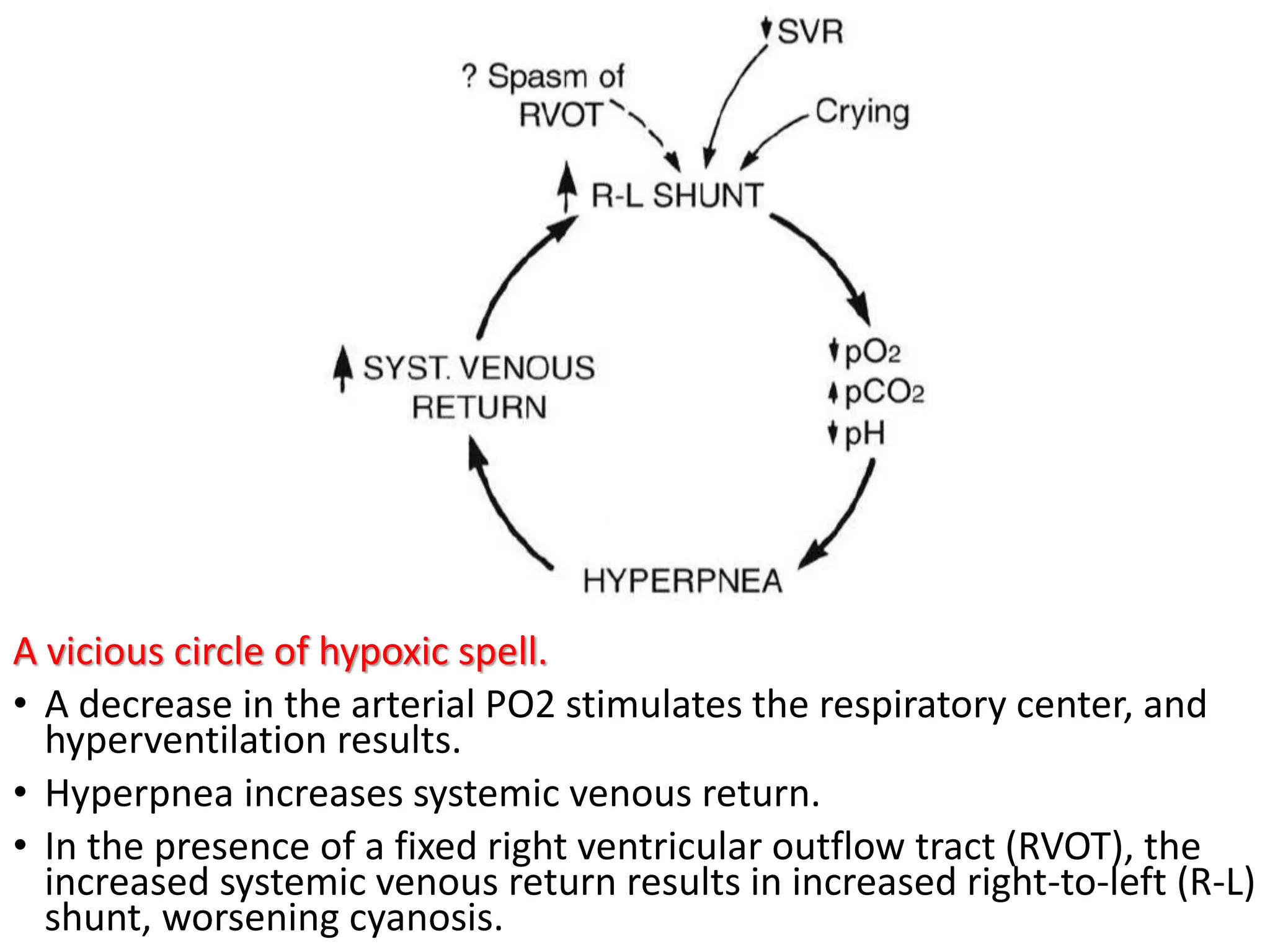 Tetralogy of Fallot (TOF) | PPTX