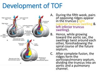 Tetralogy of Fallot (TOF) | PPTX