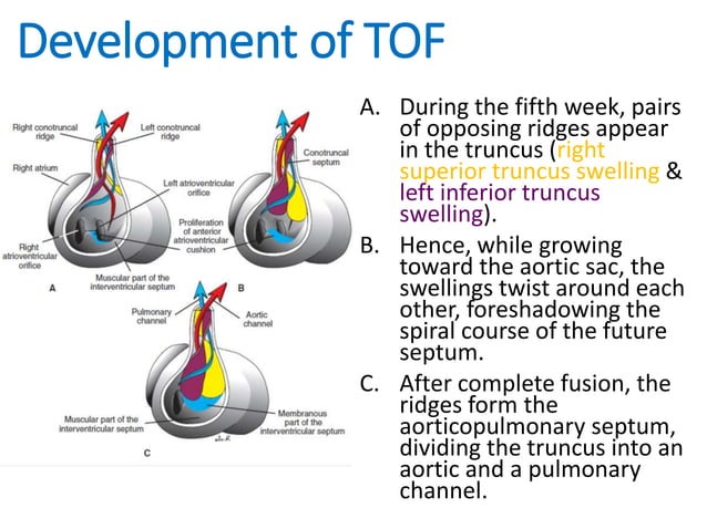 Tetralogy of Fallot (TOF) | PPTX
