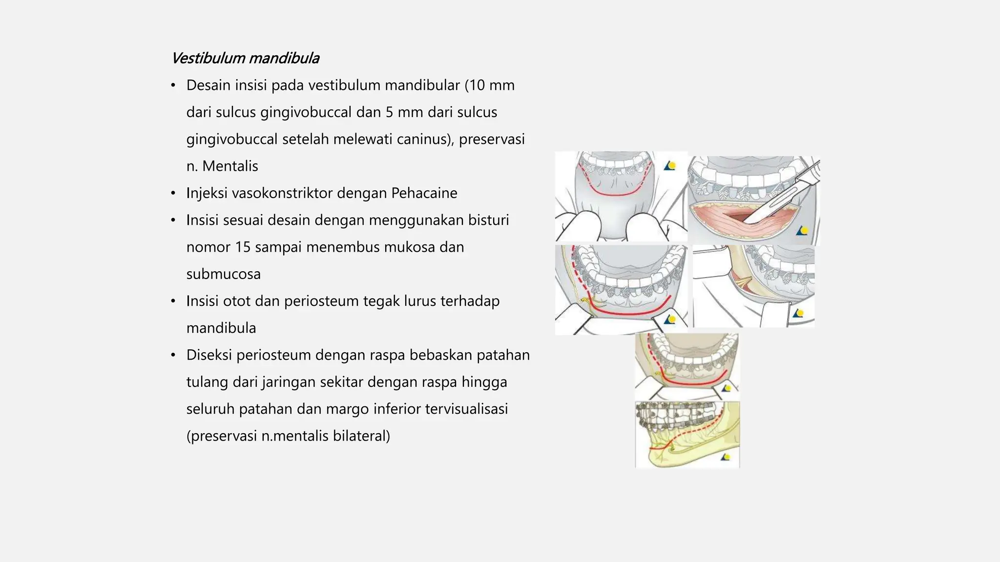 TO fraktur mandibula of oral and maxillofasial surgerypptx | PPTX