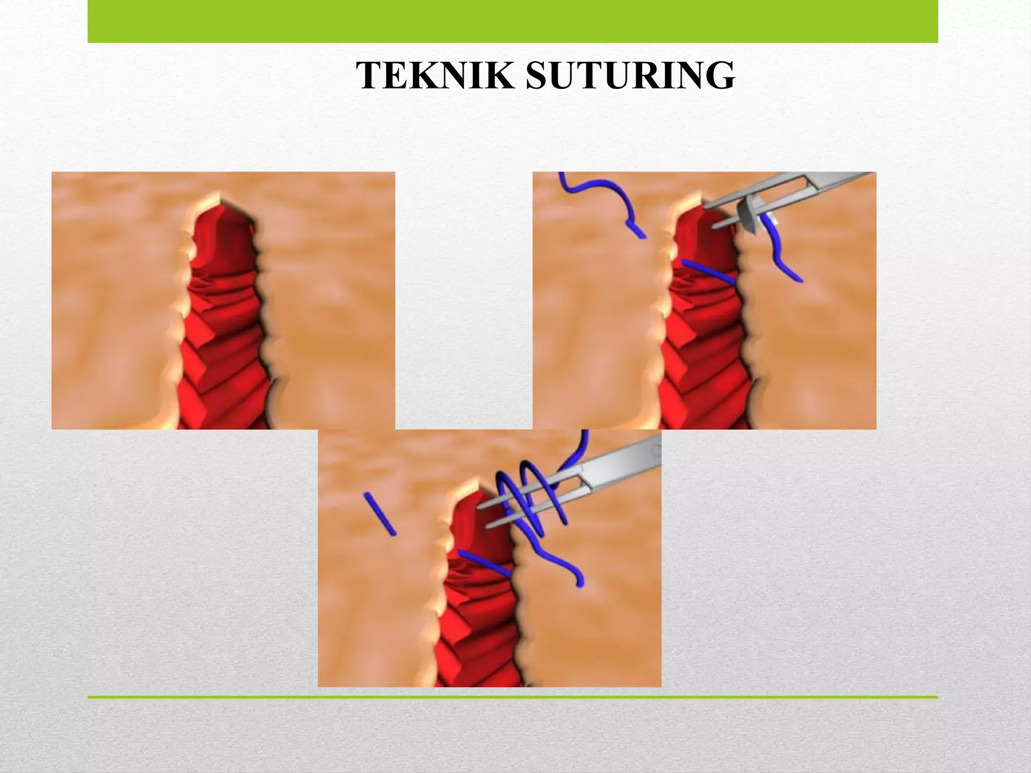 TOILET AND SUTURE | PPT