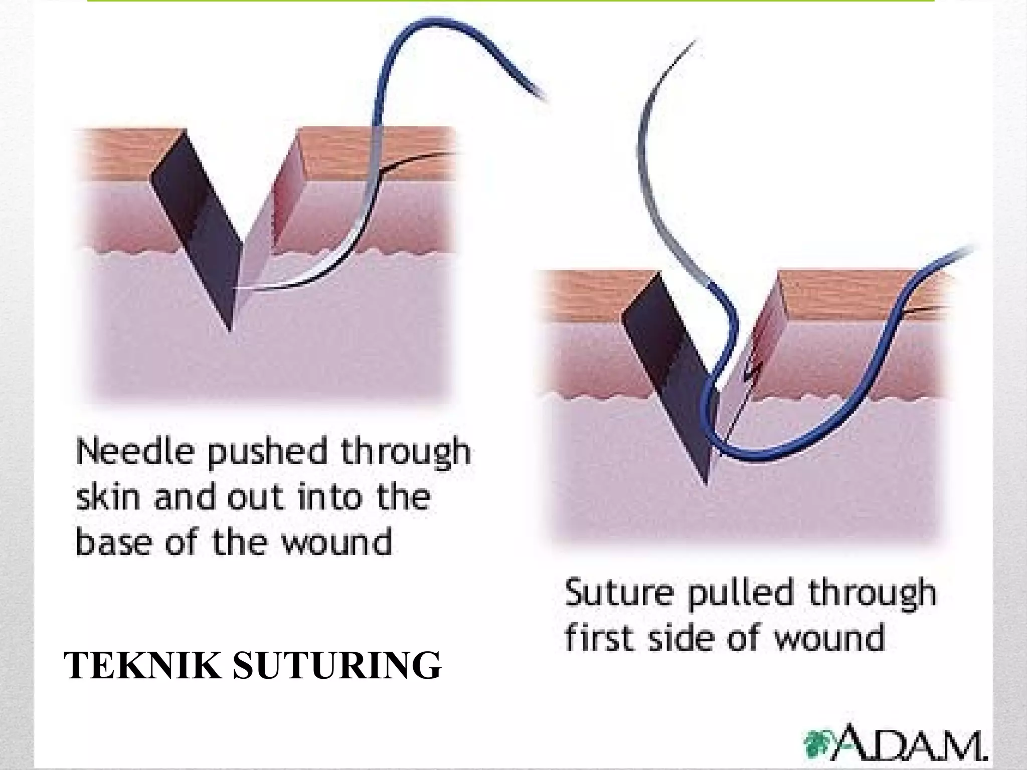 TOILET AND SUTURE | PPT