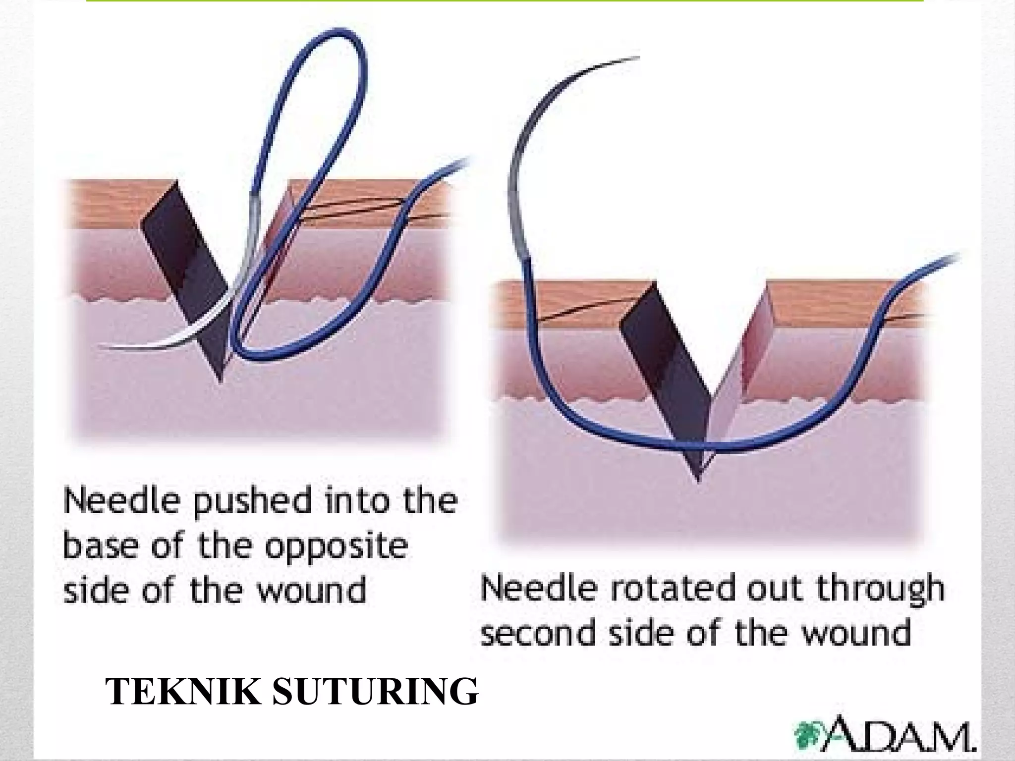 TOILET AND SUTURE | PPT