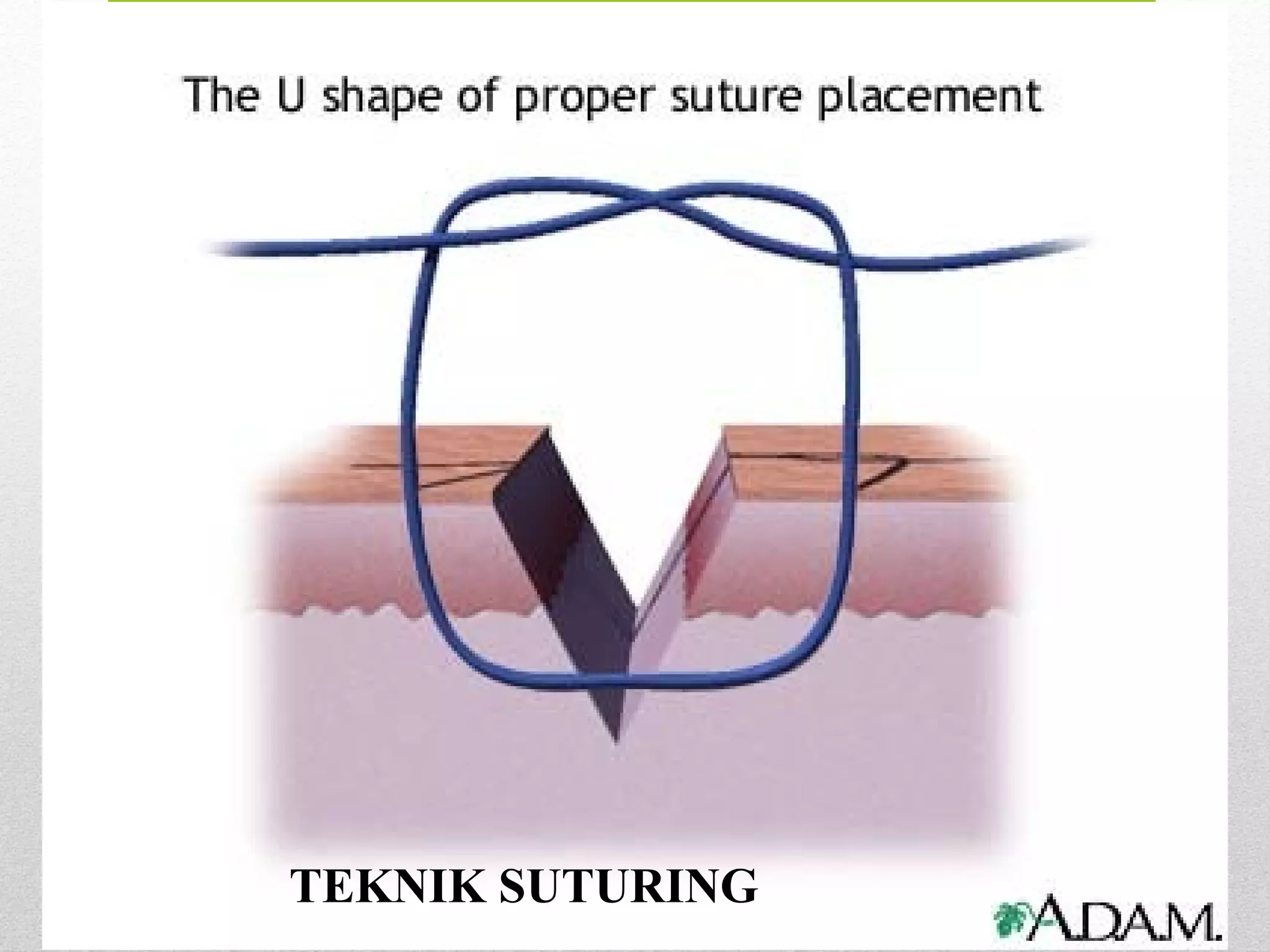 TOILET AND SUTURE | PPT