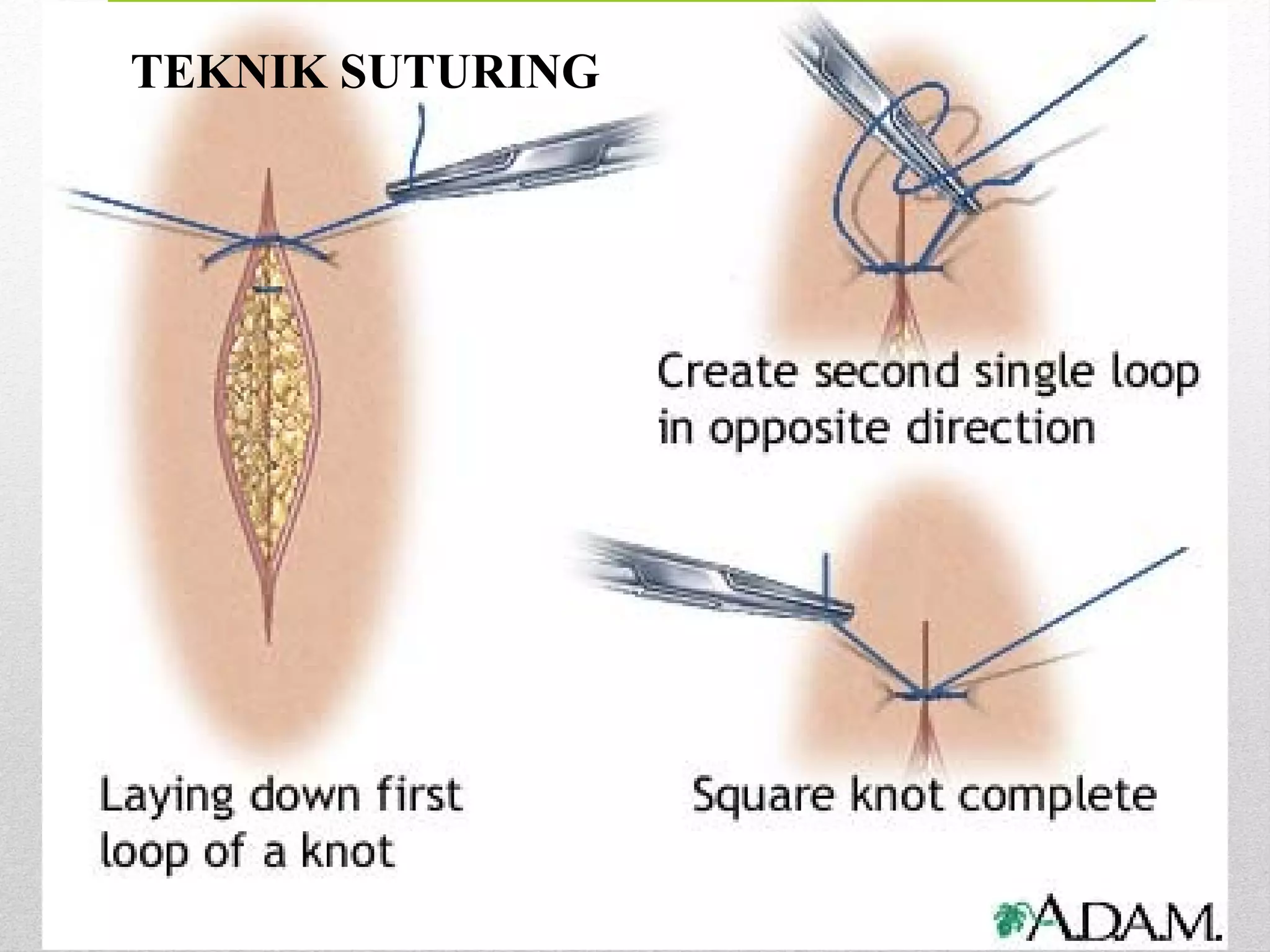 TOILET AND SUTURE | PPT