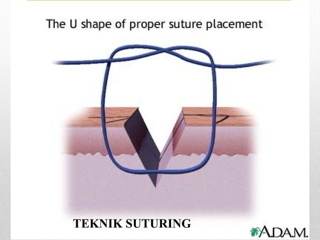 TOILET AND SUTURE | PPT