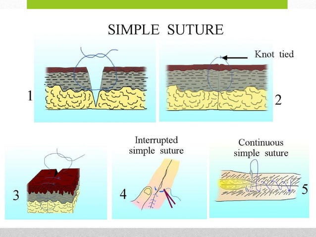 TOILET AND SUTURE | PPT