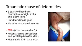 To kids with love a brief explanation of CTEV | PPT