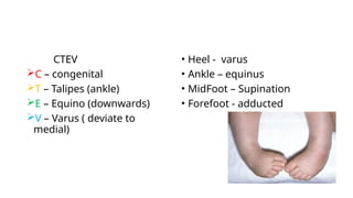 To kids with love a brief explanation of CTEV | PPT