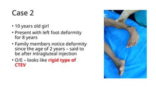 To kids with love a brief explanation of CTEV | PPT
