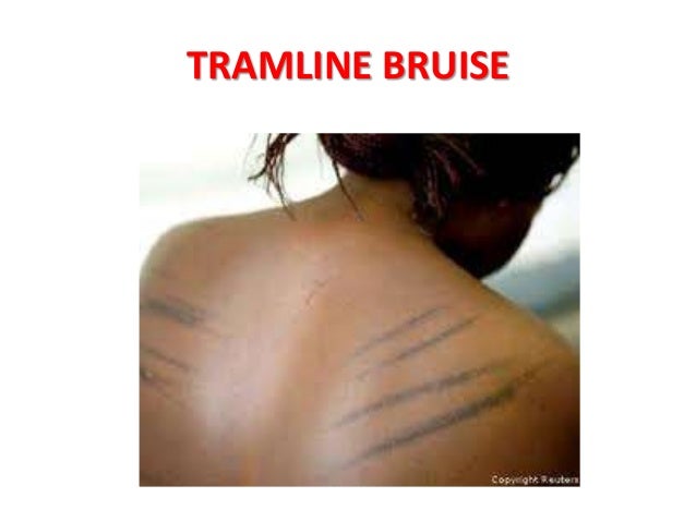 Tokyo declaration 1975