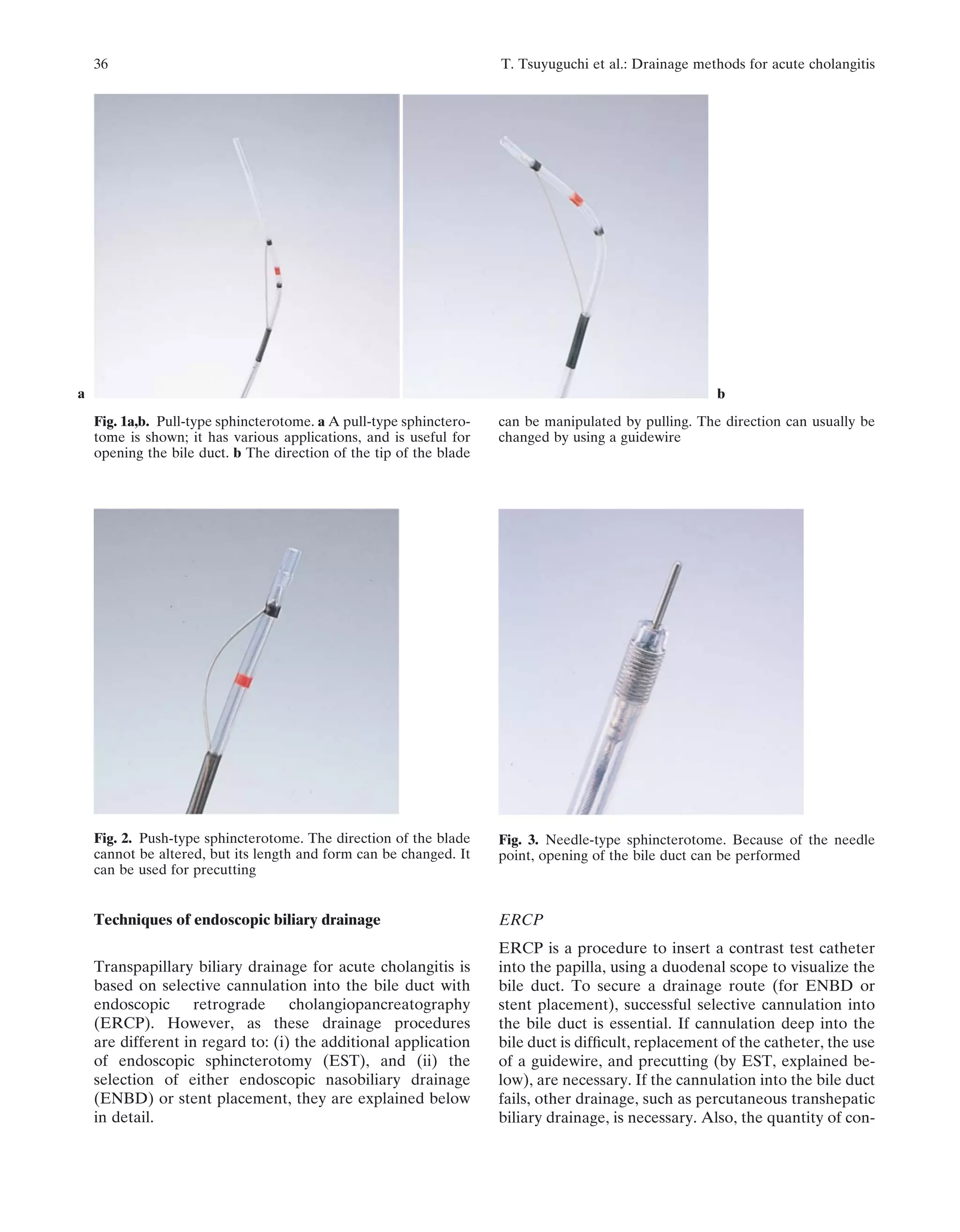 Tokyo guidelines for cholangitis and cholecystitis | PDF