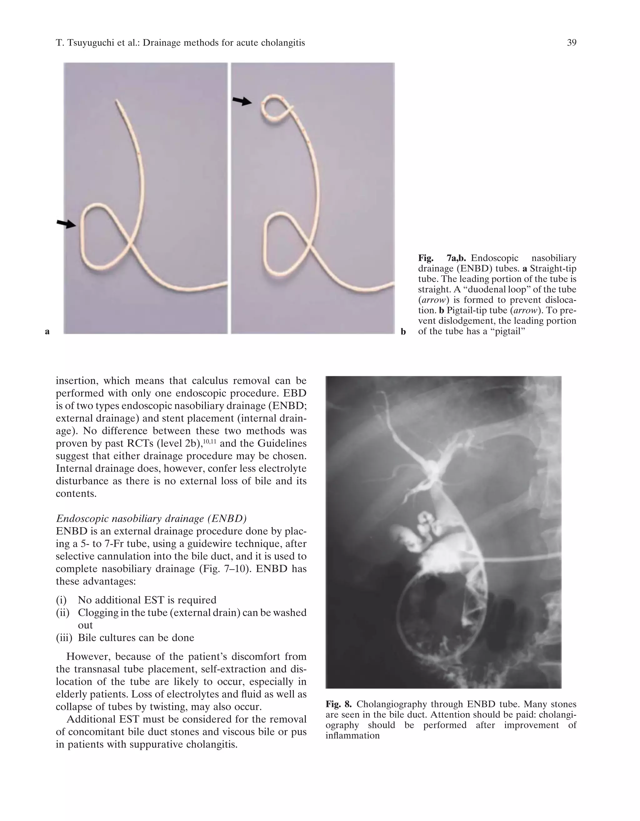 Tokyo guidelines for cholangitis and cholecystitis | PDF | Surgery ...