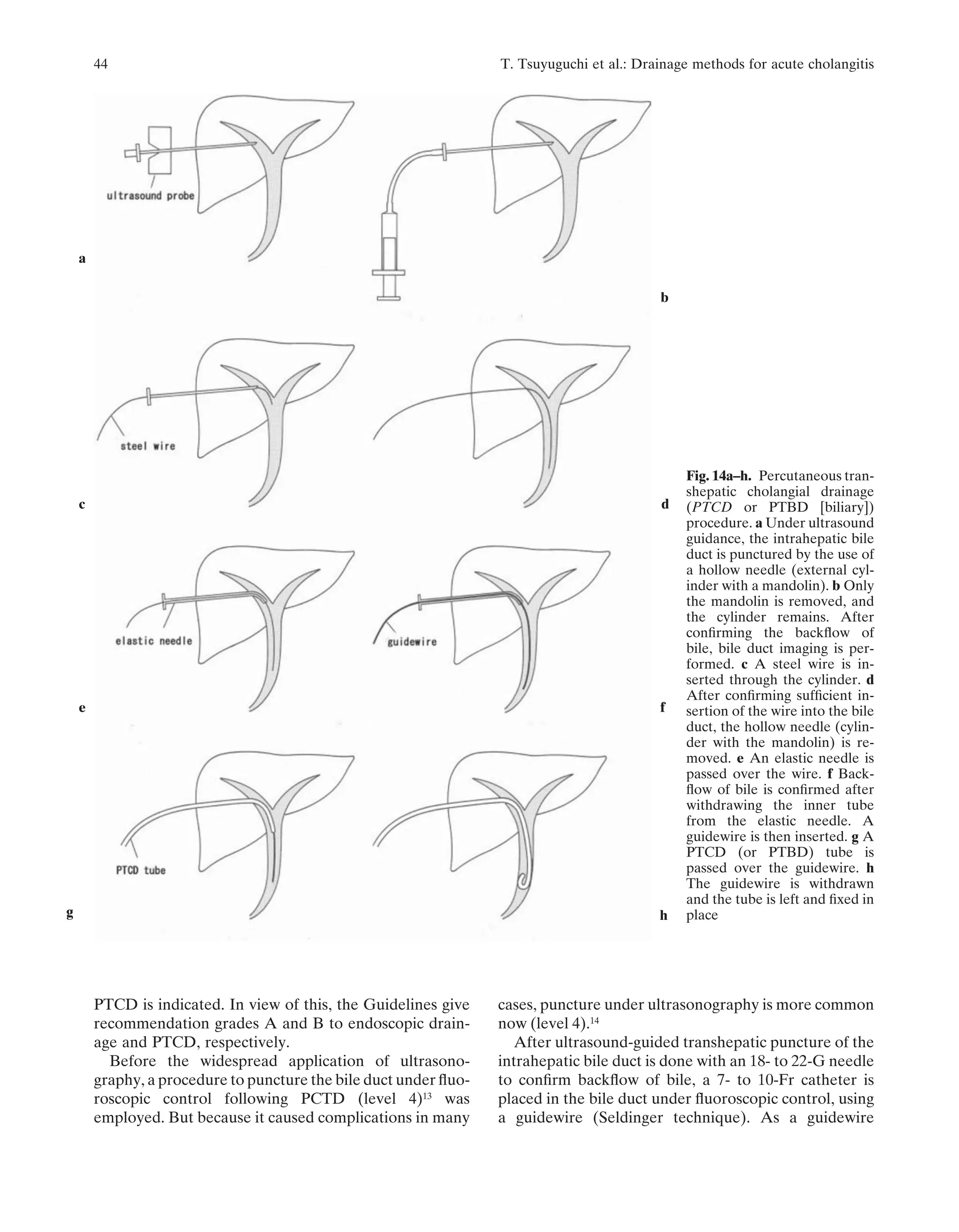 Tokyo guidelines for cholangitis and cholecystitis | PDF
