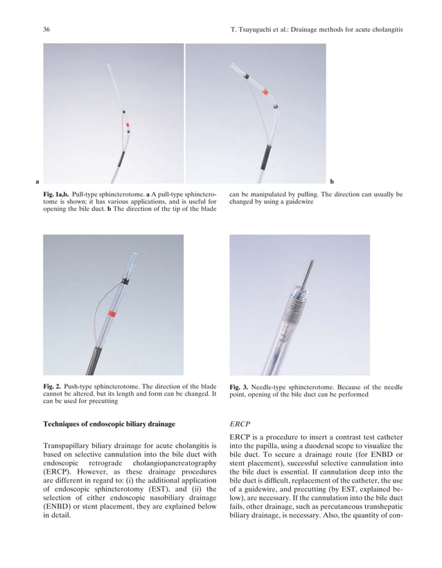 Tokyo guidelines for cholangitis and cholecystitis | PDF | Surgery ...