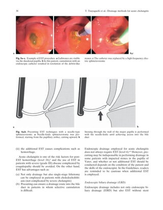 Tokyo guidelines for cholangitis and cholecystitis | PDF